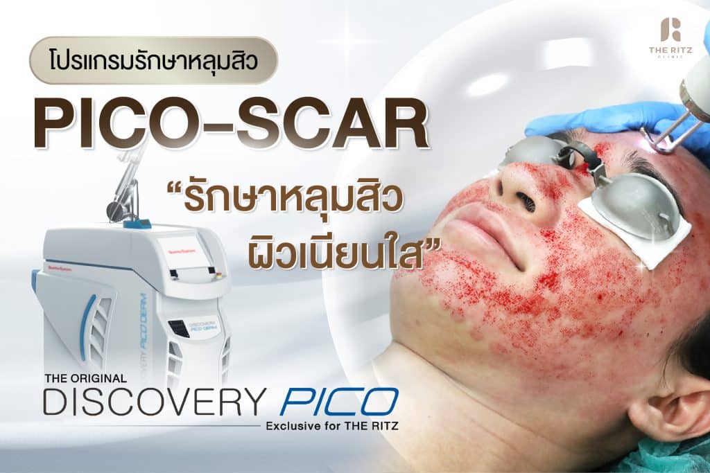 PICO-SCAR - THE RITZ CLINIC เดอะริทซ์ คลินิก