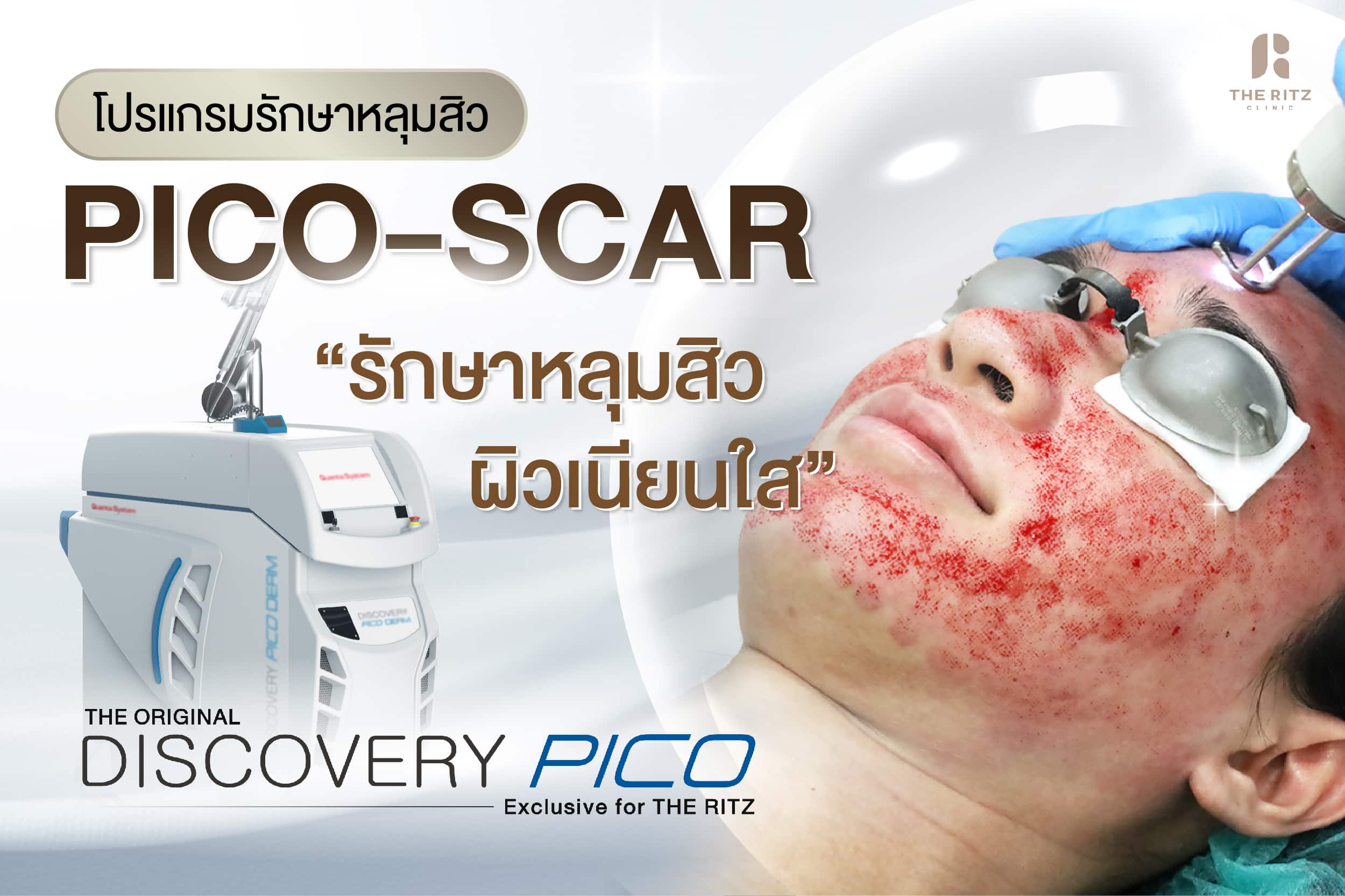 PICO-SCAR - THE RITZ CLINIC เดอะริทซ์ คลินิก