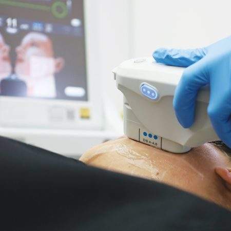 Ulthera SPT คืออะไร ยกกระชับหน้าได้ดีกว่า Ulthera แบบเดิมจริงไหม?