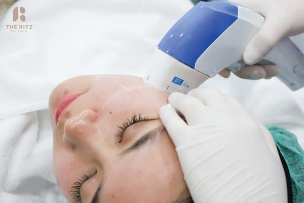 Ultraformer MPT คืออะไร ทำงานอย่างไร ยกกระชับผิวจุดไหนได้บ้าง?