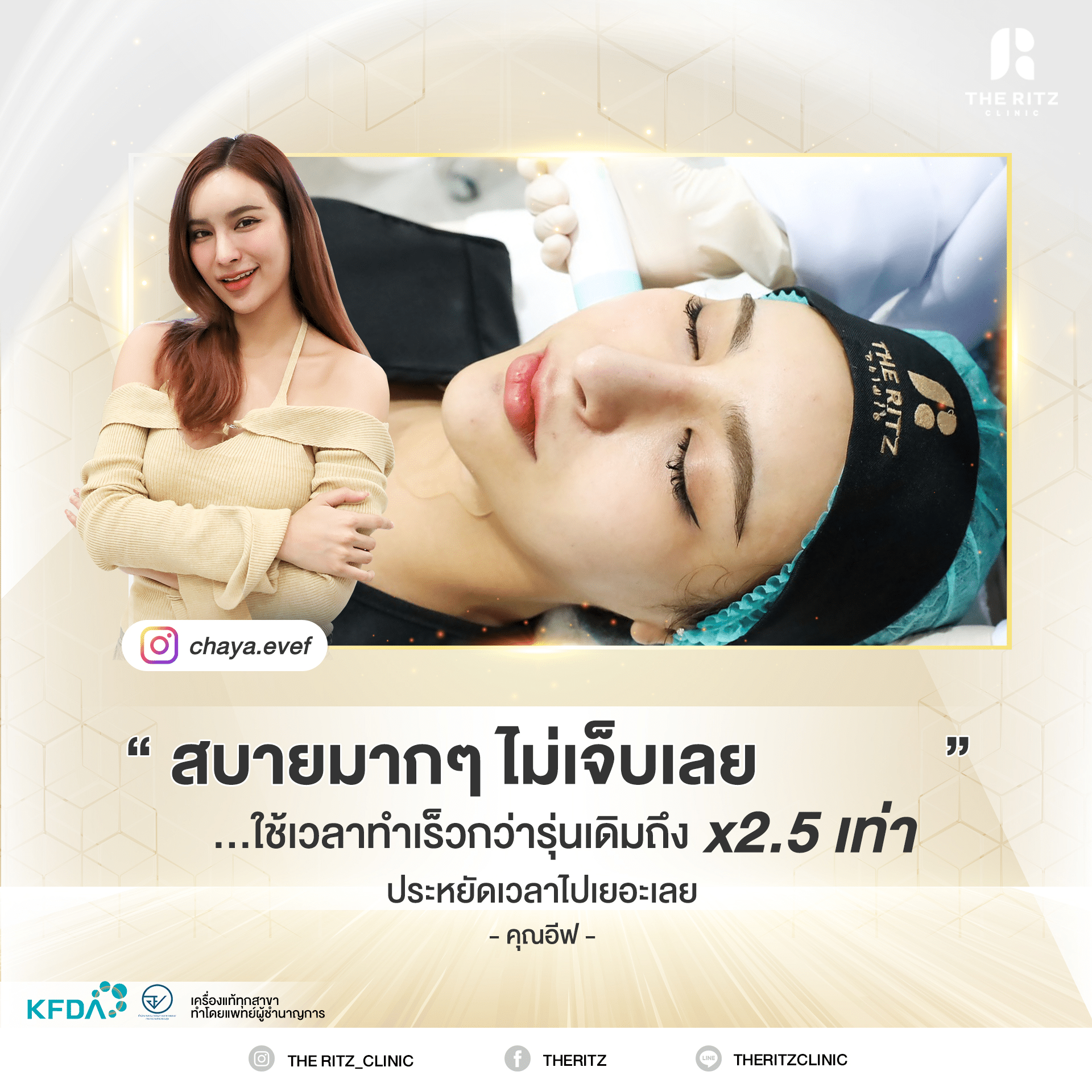 รวมรีวิว Ultraformer MPT สุดปัง ยกกระชับผิว หน้าใส ที่ The Ritz Clinic