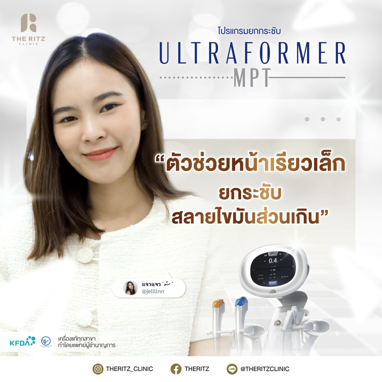 รวมรีวิว Ultraformer MPT สุดปัง ยกกระชับผิว หน้าใส ที่ The Ritz Clinic