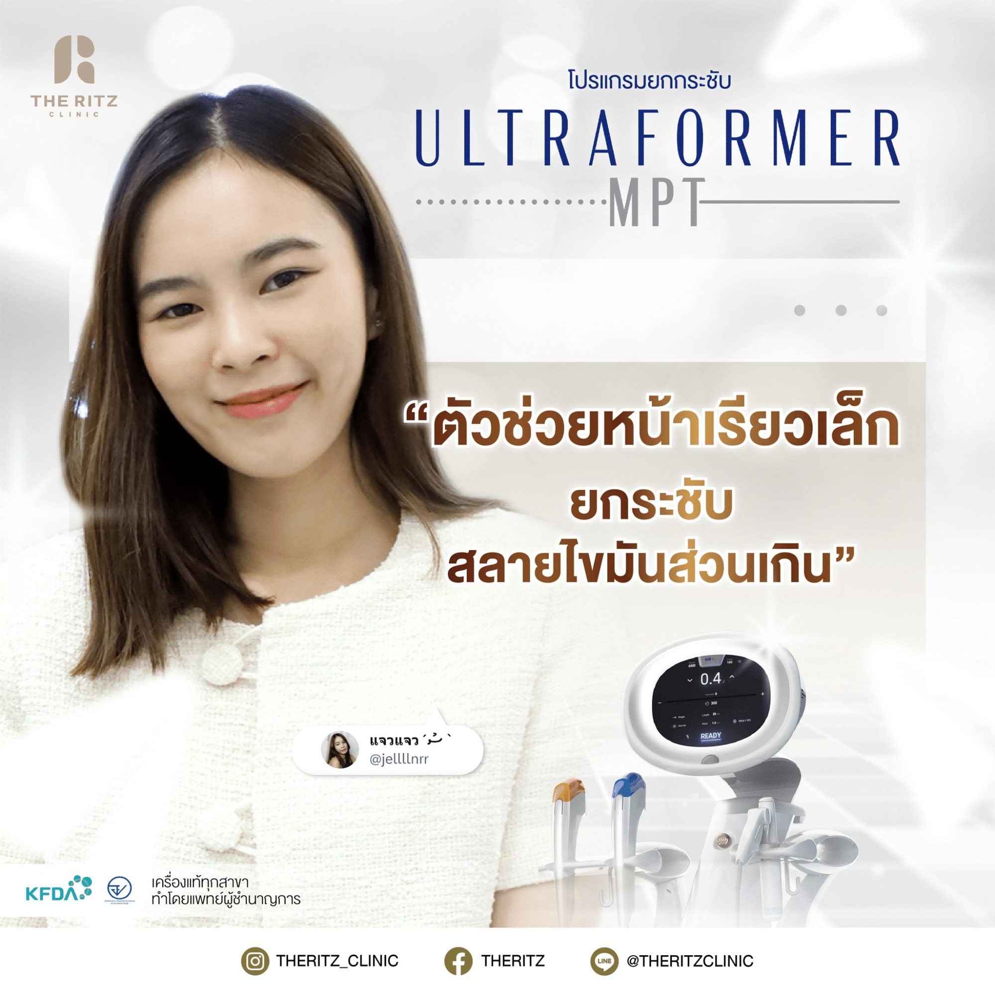รวมรีวิว Ultraformer MPT สุดปัง ยกกระชับผิว หน้าใส ที่ The Ritz Clinic