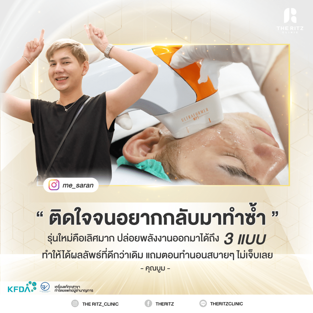 รวมรีวิว Ultraformer MPT สุดปัง ยกกระชับผิว หน้าใส ที่ The Ritz Clinic