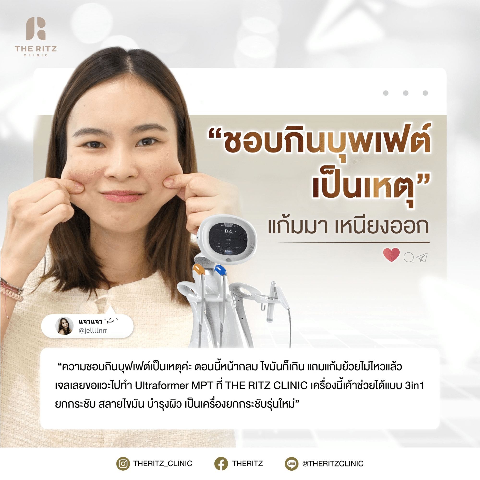 รวมรีวิว Ultraformer MPT สุดปัง ยกกระชับผิว หน้าใส ที่ The Ritz Clinic