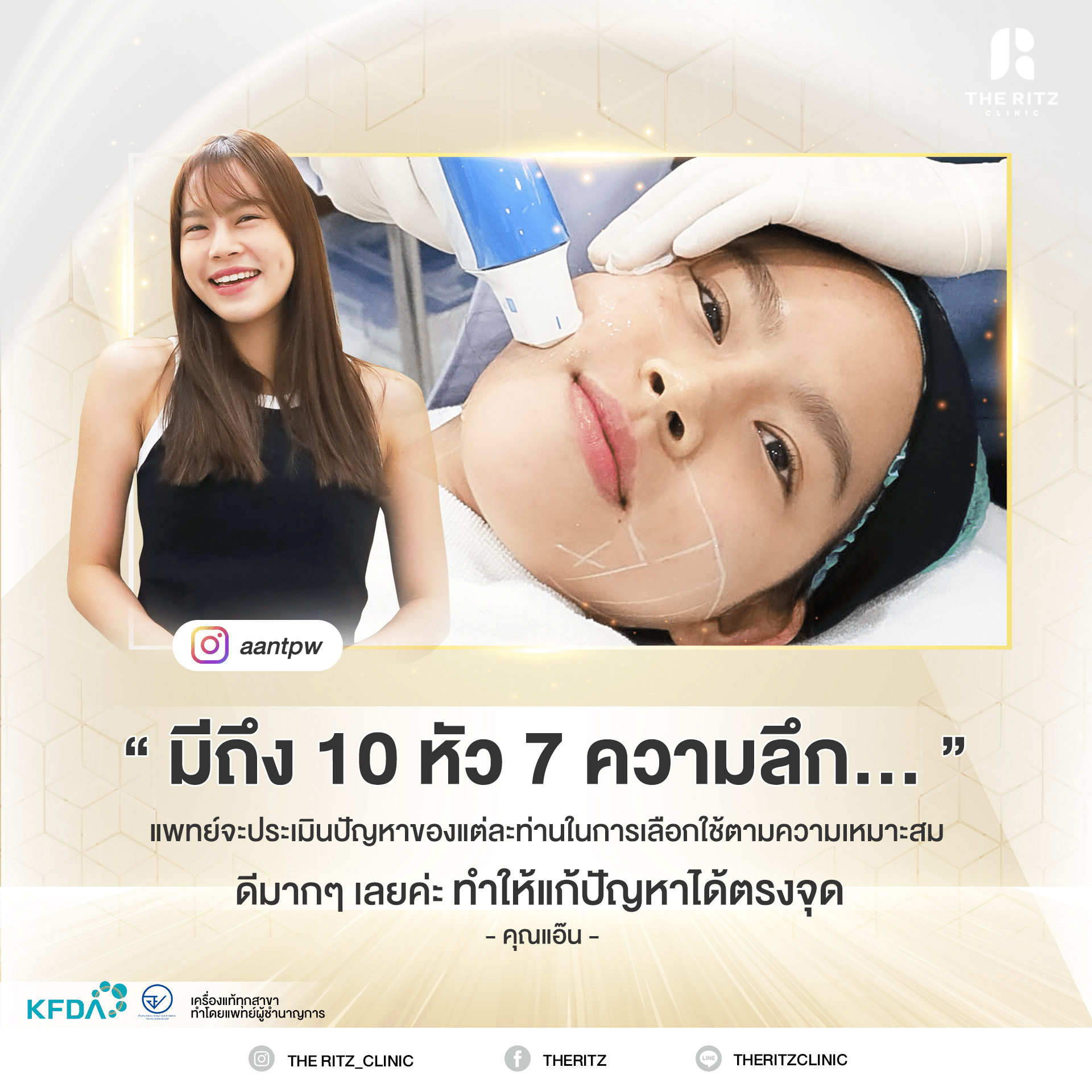 รวมรีวิว Ultraformer MPT สุดปัง ยกกระชับผิว หน้าใส ที่ The Ritz Clinic