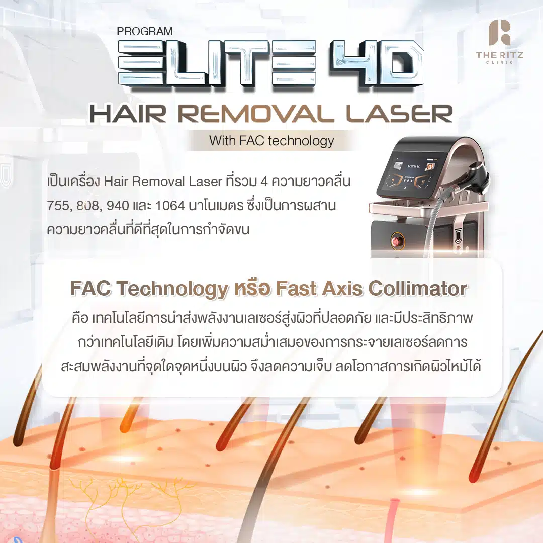 Elite 4D Hair Removal Laser เลเซอร์กำจัดขนถาวร เพื่อผิวเรียบเนียนไม่มี ...
