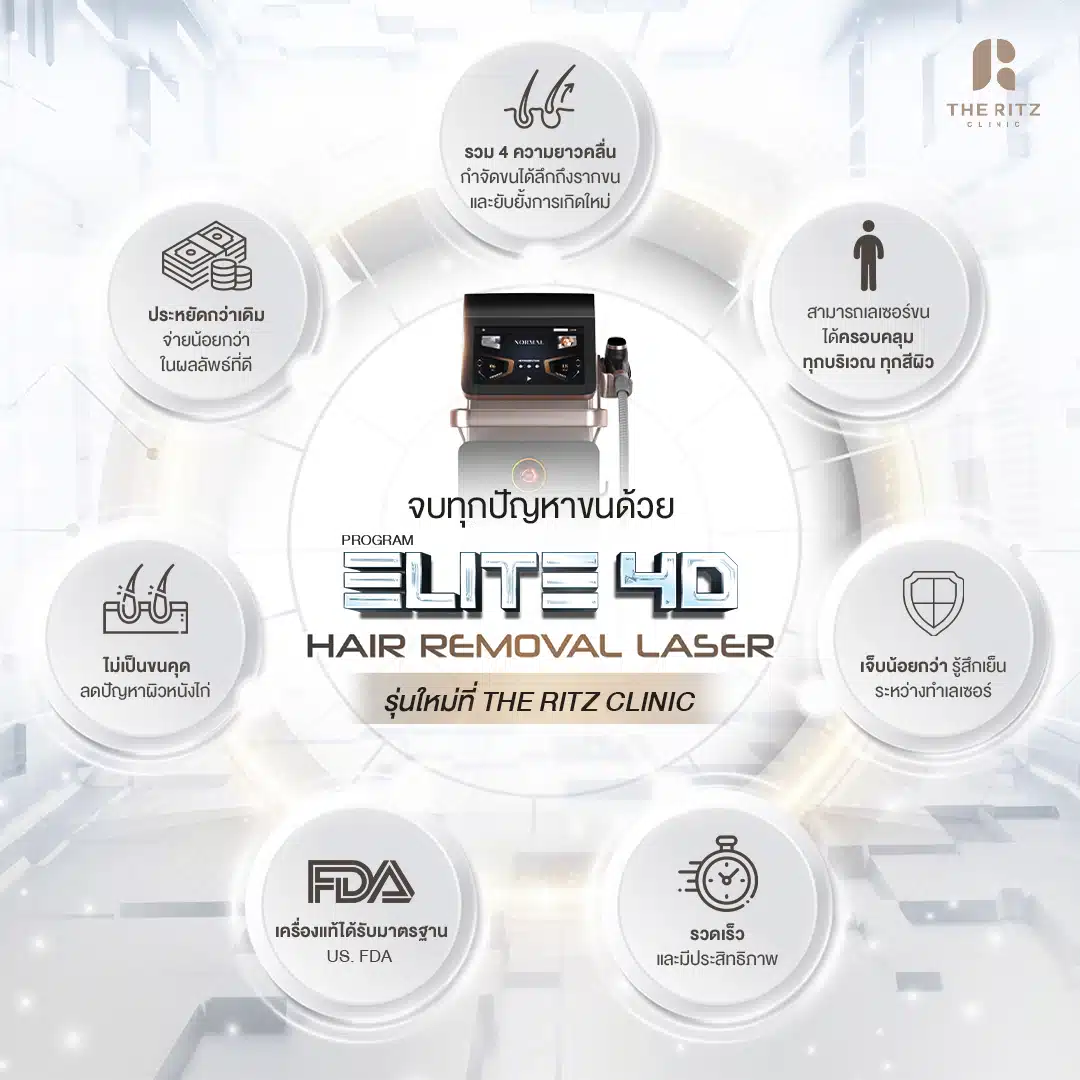 Elite 4D Hair Removal Laser เลเซอร์กำจัดขนถาวร เพื่อผิวเรียบเนียนไม่มี ...