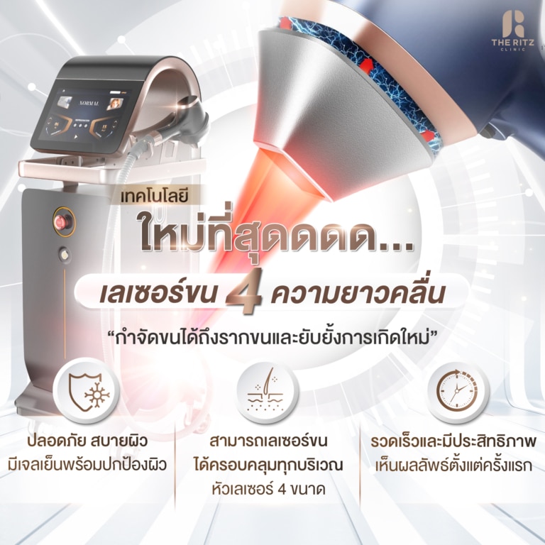 Elite 4D Hair Removal Laser เลเซอร์กำจัดขนถาวร เพื่อผิวเรียบเนียนไม่มี ...