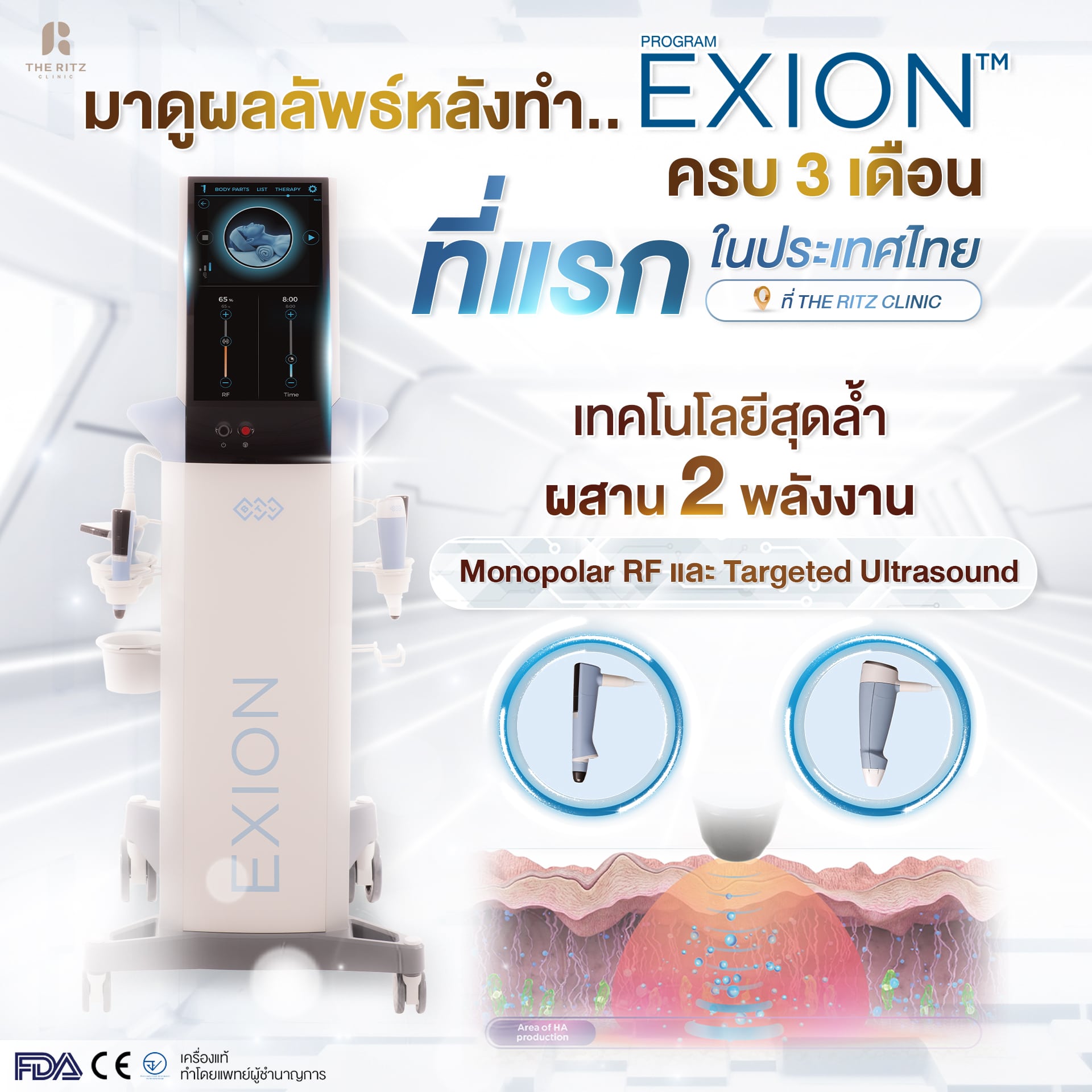 EXION เทคโนโลยีใหม่สำหรับผิวพรรณทั่วเรือนร่าง - THE RITZ CLINIC เดอะริทซ์ คลินิก