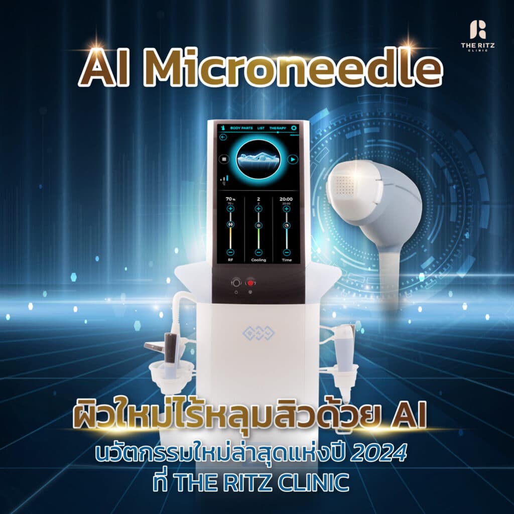 EXION โปรแกรม AI Microneedle RF - THE RITZ CLINIC เดอะริทซ์ คลินิก